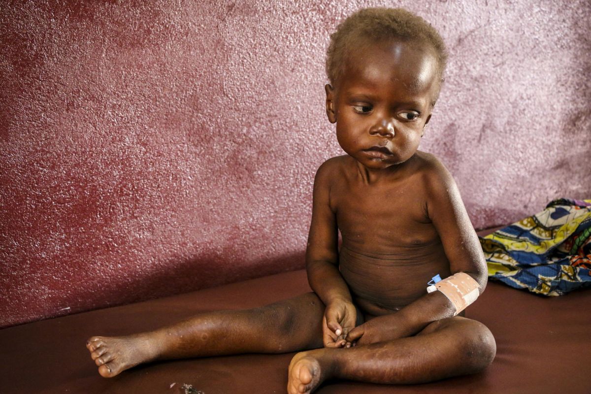 Help us provide therapeutic food and emergency supplies | UNICEF Global