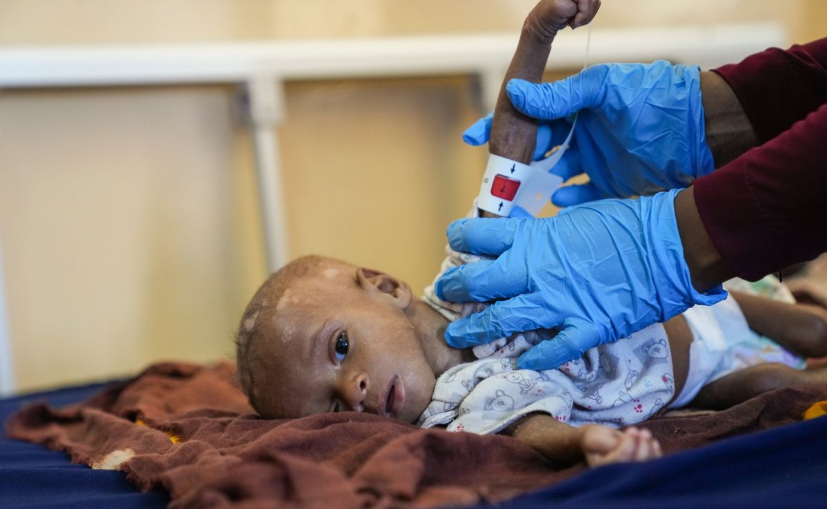 Children in the Horn of Africa are starving | UNICEF Global