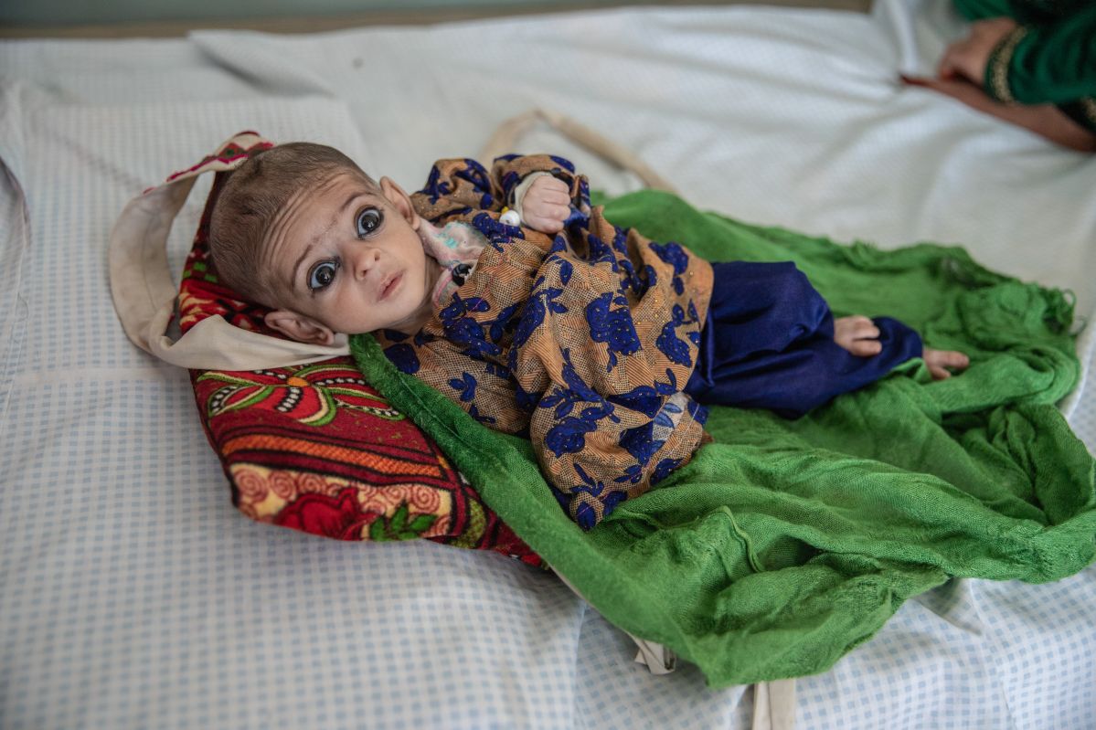 Hunger in Afghanistan | UNICEF Global