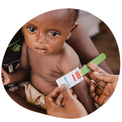 Help save a child from severe malnutrition | UNICEF Global